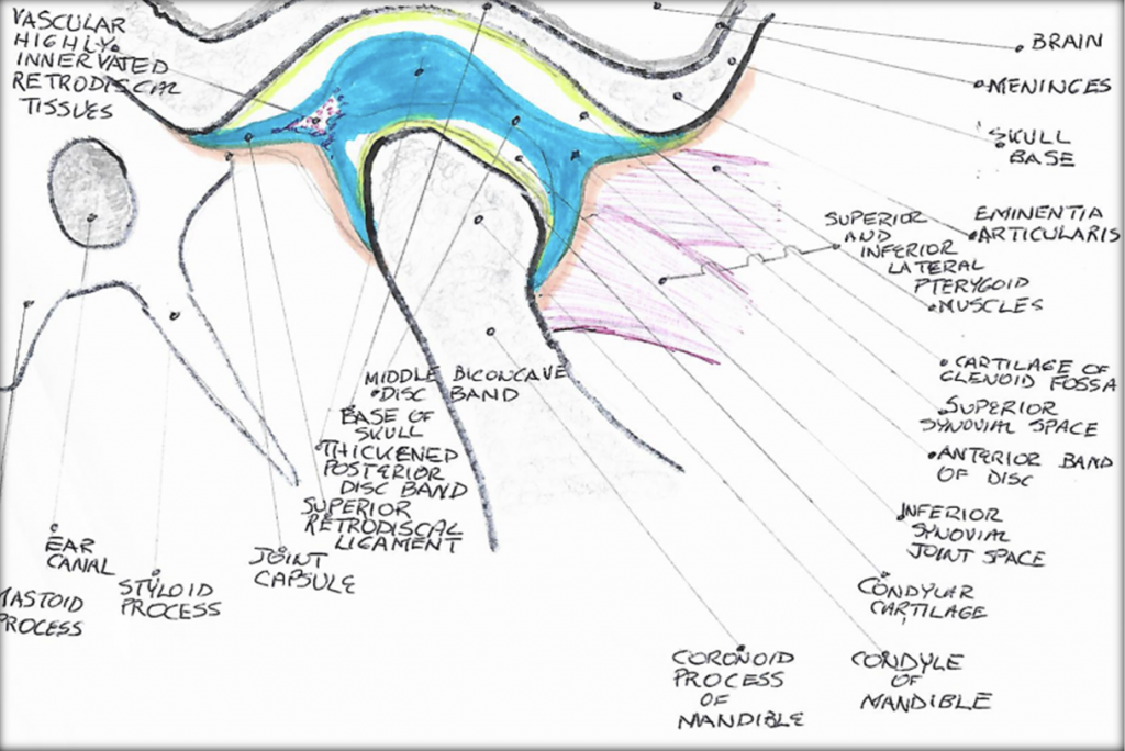 Occlusal Splint Therapy Cairns | TMD Treatment | Future Dental