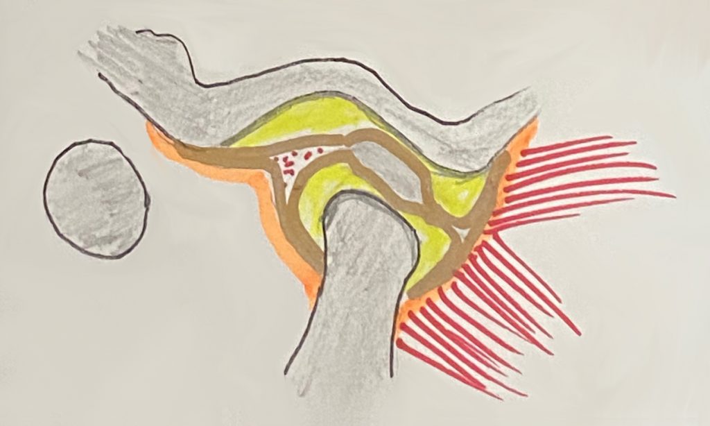 TMJ Pain and Temporomandibular Disorders Cairns | Future Dental
