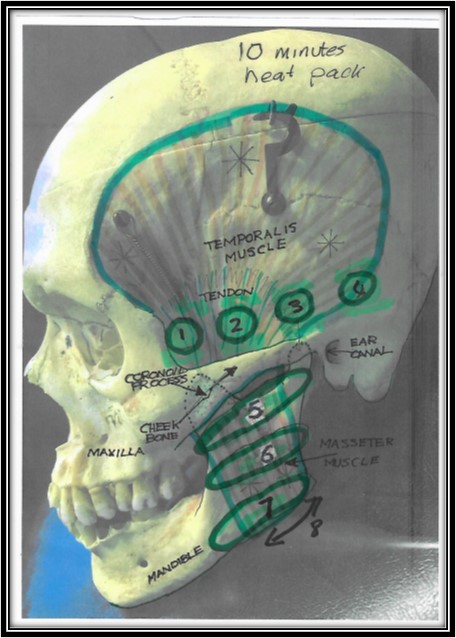 Myofunctional Exercises for Myofascial & TMJ Pain | Future Dental Cairns